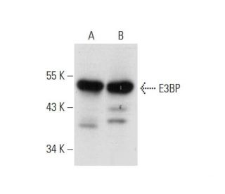 Anti-E3BP Antibody (H-6) | SCBT - Santa Cruz Biotechnology
