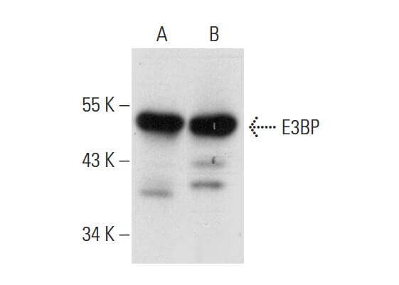Anti-E3BP Antibody (H-6) | SCBT - Santa Cruz Biotechnology