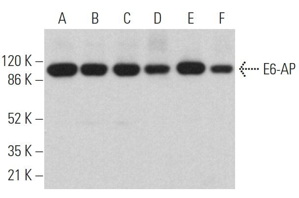 E6-AP Antibody (E-4) | SCBT - Santa Cruz Biotechnology