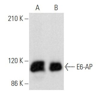 E6-AP Antibody (F-1) | SCBT - Santa Cruz Biotechnology