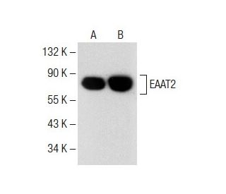 EAAT2 Antibody (E-1) - Western Blotting - Image 143402