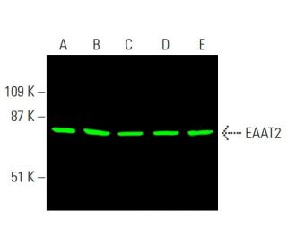 EAAT2 Antibody (E-1) - Western Blotting - Image 377788