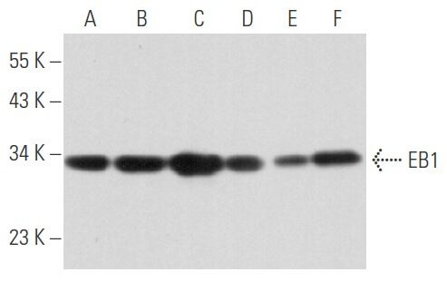 EB1抗体 (1A11/4) | SCBT - Santa Cruz Biotechnology