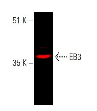EB3 Antibody (7) | SCBT - Santa Cruz Biotechnology