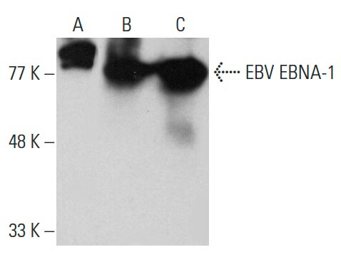 Anti-EBV EBNA-1 Antibody (1EB12) | SCBT - Santa Cruz Biotechnology
