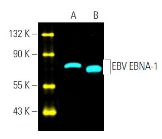 Anti-EBV EBNA-1 Antibody (1EB12) | SCBT - Santa Cruz Biotechnology