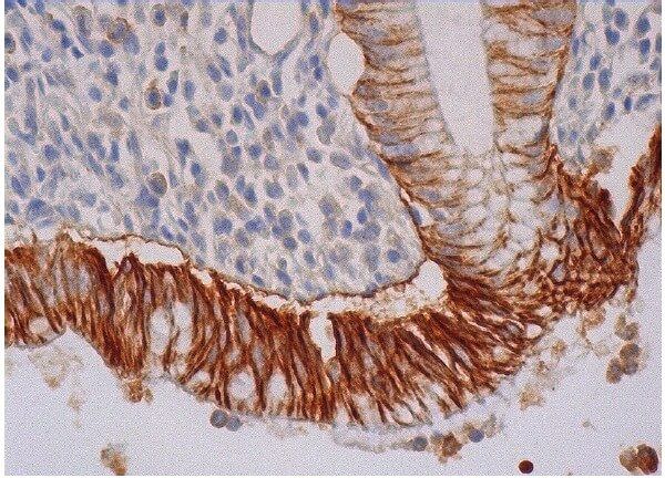 Edc4 Antibody (H-12) | SCBT - Santa Cruz Biotechnology