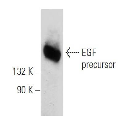 EGF 항체 (R-20) | SCBT - Santa Cruz Biotechnology