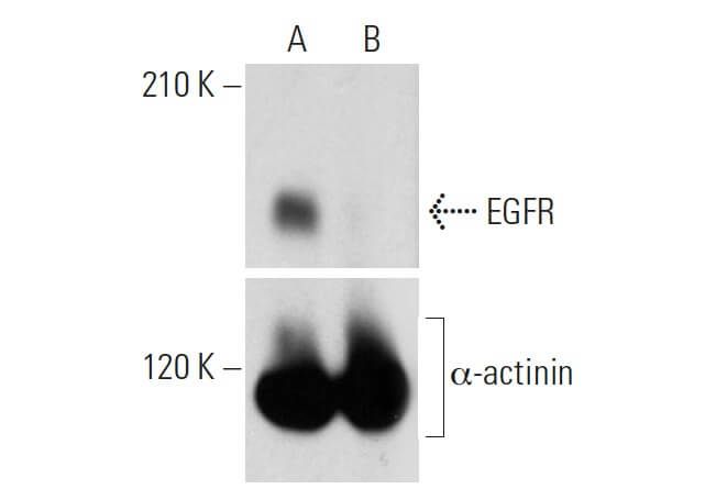 EGFR CRISPR Knockout and Activation Products (h) | SCBT - Santa Cruz ...