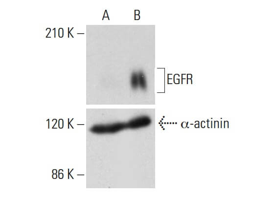EGFR CRISPR Knockout and Activation Products (h) | SCBT - Santa Cruz ...