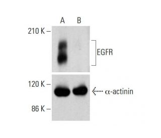 EGFR CRISPR Knockout and Activation Products (h) | SCBT - Santa Cruz ...