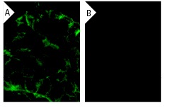 EGFR siRNA (h), shRNA and Lentiviral Particle Gene Silencers | SCBT ...