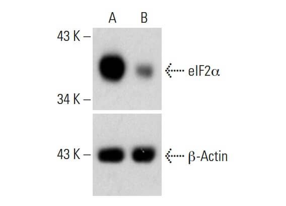 eIF2alpha CRISPR Knockout and Activation Products (h) | SCBT - Santa ...