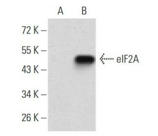 eIF2A Antibody (3A7A8) - Western Blotting - Image 358313