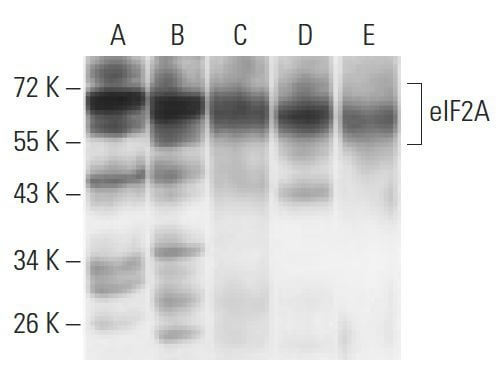 Anti-eIF2A Antibody (3A7A8) | SCBT - Santa Cruz Biotechnology