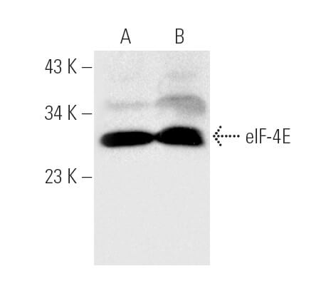Anti-eIF4E Antibody (P-2) | SCBT - Santa Cruz Biotechnology