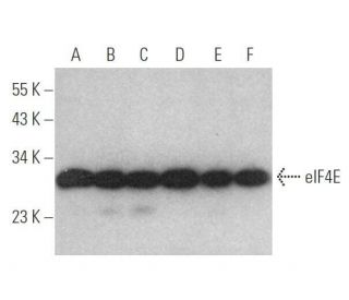 Anti-eIF4E Antibody (P-2) | SCBT - Santa Cruz Biotechnology