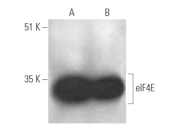 Anti-eIF4E Antibody (P-2) | SCBT - Santa Cruz Biotechnology