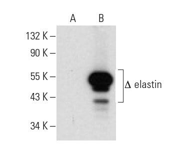 elastin Antibody (F-5) | SCBT - Santa Cruz Biotechnology