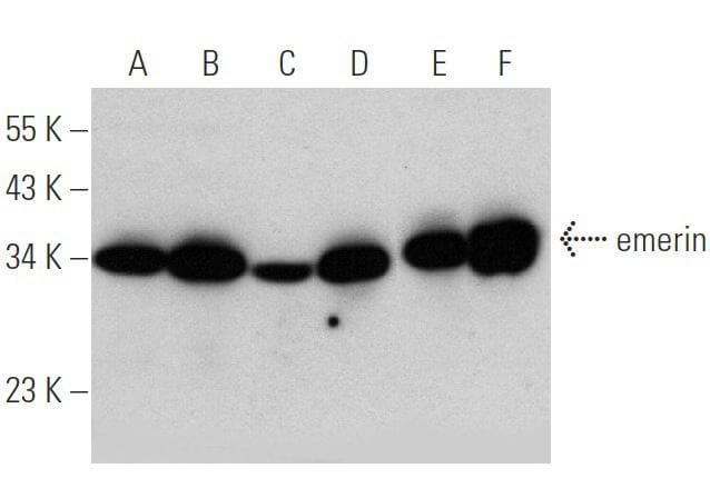 emerin Antibody (A-5) | SCBT - Santa Cruz Biotechnology