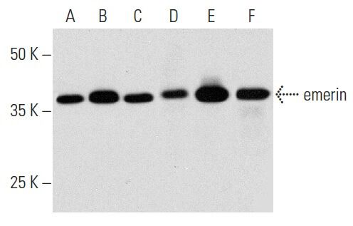 emerin Antibody (A-5) | SCBT - Santa Cruz Biotechnology