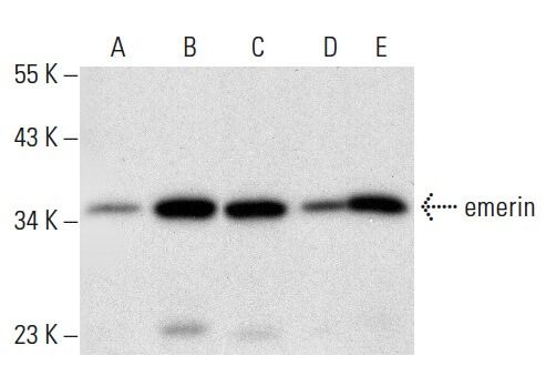 emerin Antibody (F-11) | SCBT - Santa Cruz Biotechnology