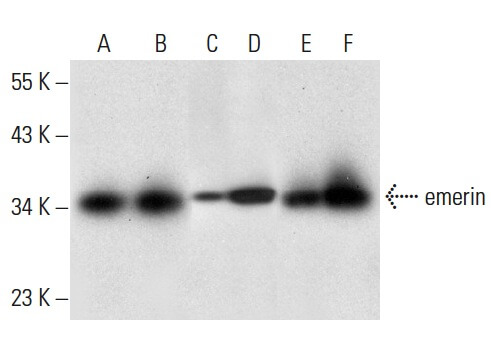 emerin Antibody (H-12) | SCBT - Santa Cruz Biotechnology