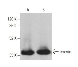 emerin Antibody (H-12) - Western Blotting - Image 378157