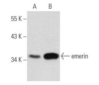 emerin Antibody (MANEM5) - Western Blotting - Image 356983
