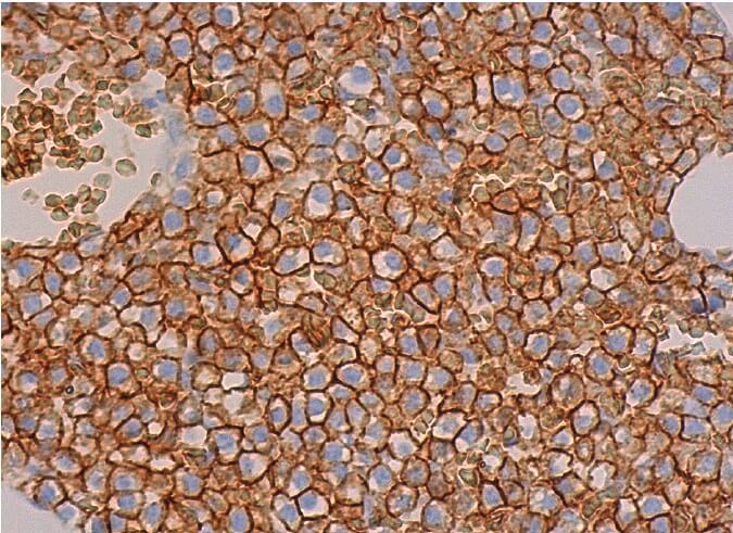 EMMPRIN/CD147 Antibody (OX114) | SCBT - Santa Cruz Biotechnology