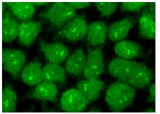 Anti-ENDOG Antibody (B-2) | SCBT - Santa Cruz Biotechnology