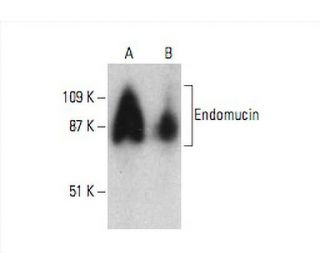 Endomucin Antibody (V.5C7) | SCBT - Santa Cruz Biotechnology