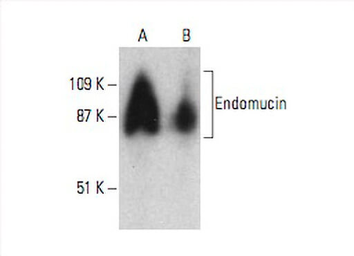 Endomucin Antibody (V.5C7) | SCBT - Santa Cruz Biotechnology