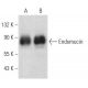 Endomucin Antibody (V.7C7) | SCBT - Santa Cruz Biotechnology