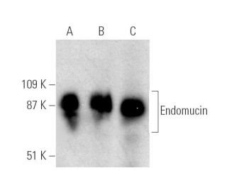 Endomucin Antibody (V.7C7) - Western Blotting - Image 388944