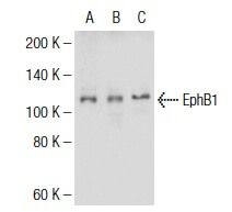 EphB1 Antibody (5F10A4) | SCBT - Santa Cruz Biotechnology