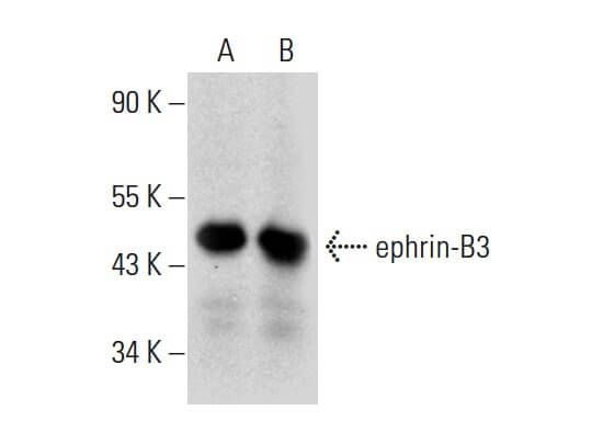 ephrin-B3抗体 (A-7) | SCBT - Santa Cruz Biotechnology