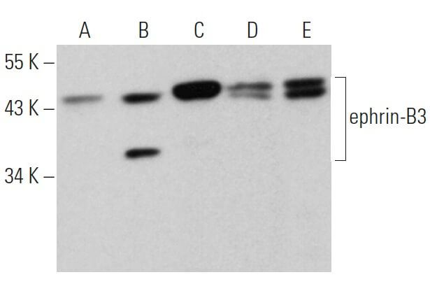 ephrin-B3抗体 (D-11) | SCBT - Santa Cruz Biotechnology