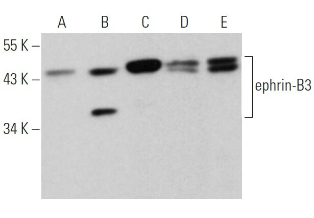 ephrin-B3 Antibody (D-11) | SCBT - Santa Cruz Biotechnology