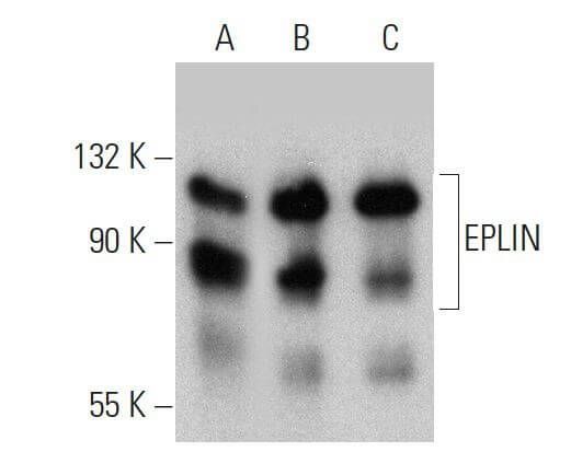 EPLIN Antibody (20) | SCBT - Santa Cruz Biotechnology