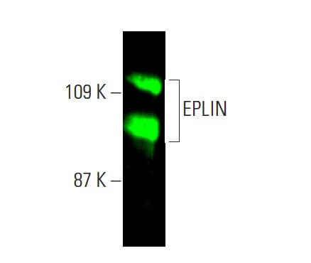 EPLIN Antibody (20) | SCBT - Santa Cruz Biotechnology