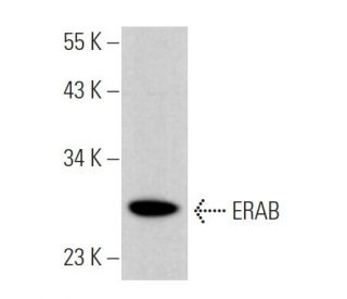 Anti-ERAB Antibody (E-10) | SCBT - Santa Cruz Biotechnology