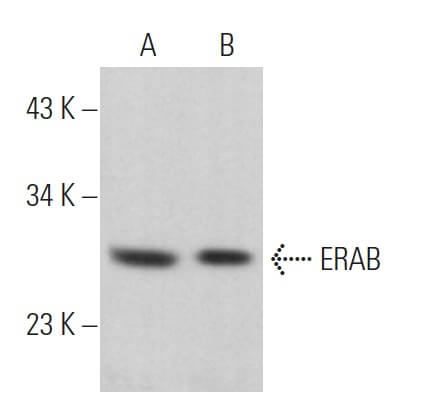 Anti-ERAB Antibody (E-10) | SCBT - Santa Cruz Biotechnology