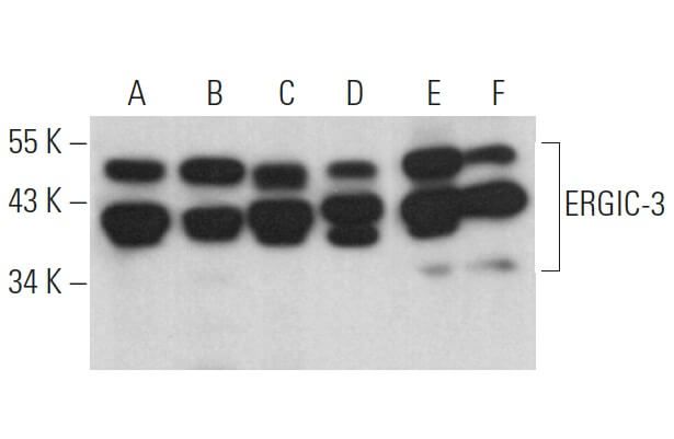 Anticorps ERGIC-3 (E-3) | SCBT - Santa Cruz Biotechnology