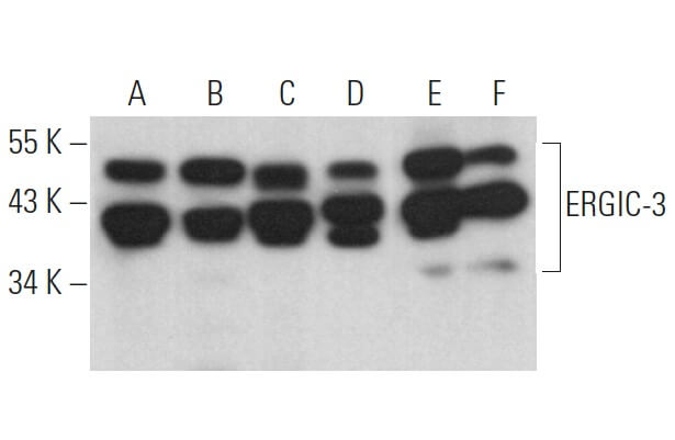 ERGIC-3 Antibody (E-3) | SCBT - Santa Cruz Biotechnology