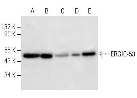 ERGIC-53 Antibody (G-11) | SCBT - Santa Cruz Biotechnology
