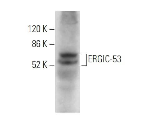 Anti-ERGIC-53 Antibody (G-11) | SCBT - Santa Cruz Biotechnology