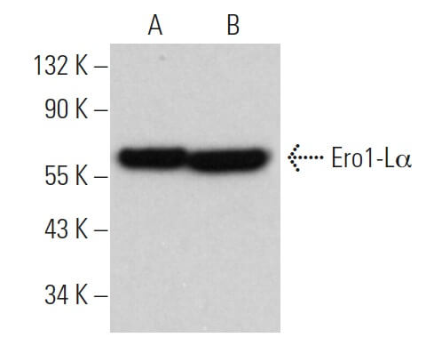 Ero1-Lα Antibody (D-7) | SCBT - Santa Cruz Biotechnology