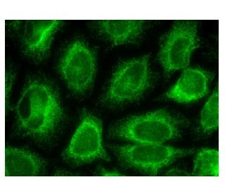 Anti-ERp5 Antibody (F-5) | SCBT - Santa Cruz Biotechnology