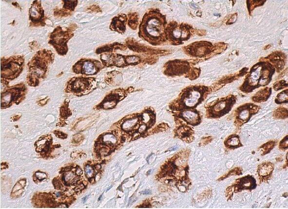 Anti-ERp5 Antibody (G-5) | SCBT - Santa Cruz Biotechnology